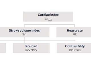 Advanced Monitoring Parameters: CI, SVI - Getinge