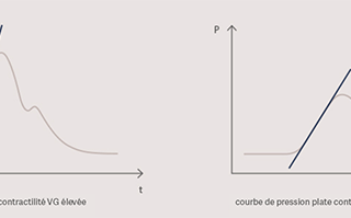 Advanced Monitoring Parameters: dPmx - Getinge