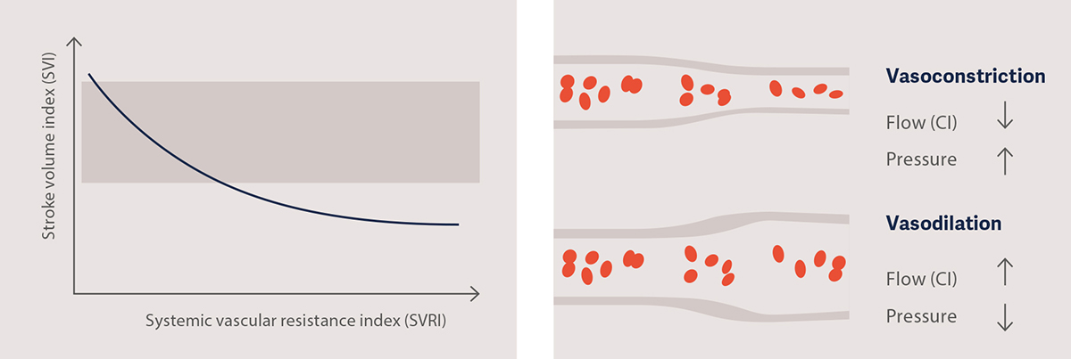 Advanced Monitoring Parameters: SVRI