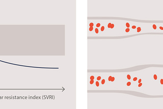 Advanced Monitoring Parameters: SVRI - Getinge