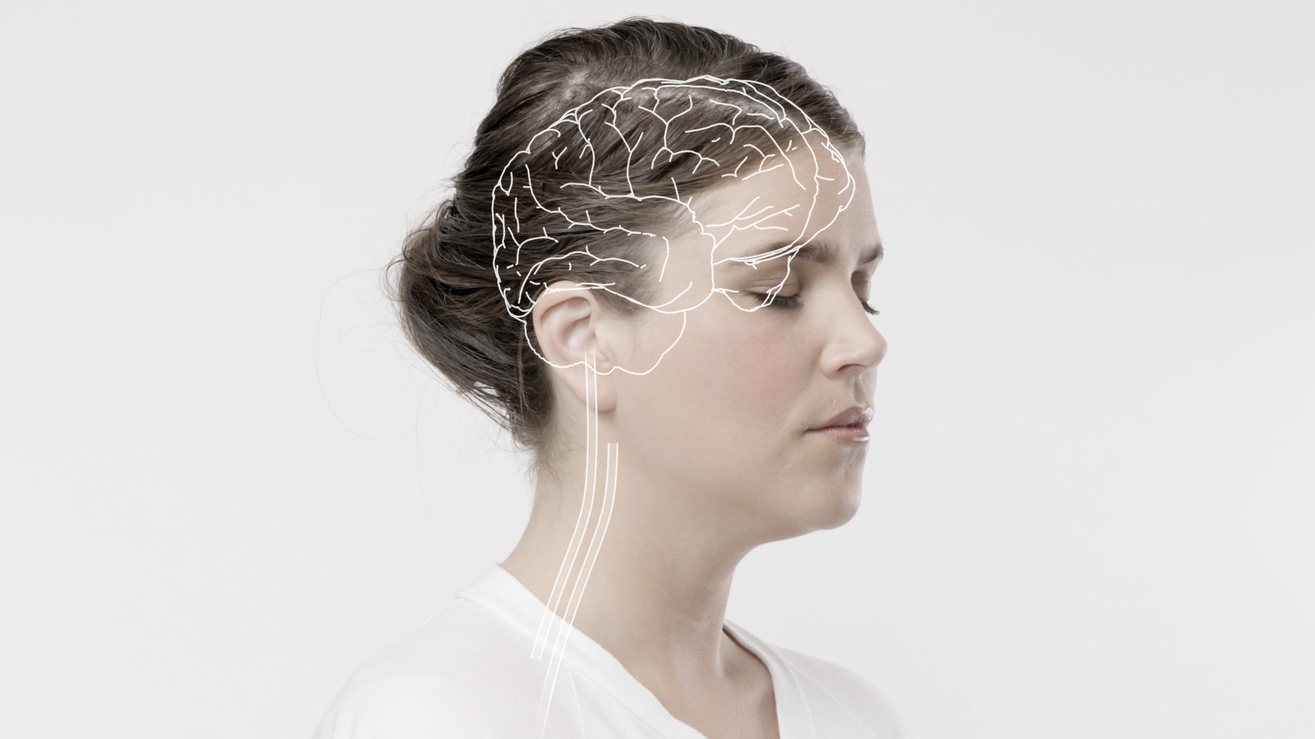 Beademing - De kracht van NAVA - Getinge