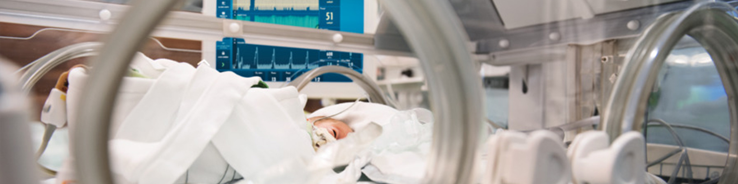 NAVA: Die stille Revolution in der Intensivbeatmung