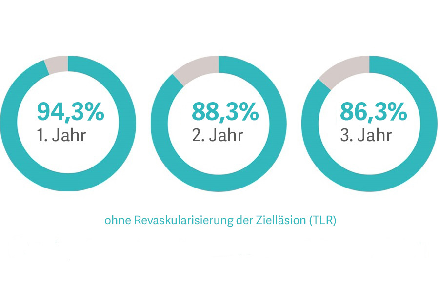 Advanta V12 Ballonexpandierbarer gecoverter Stents - Getinge