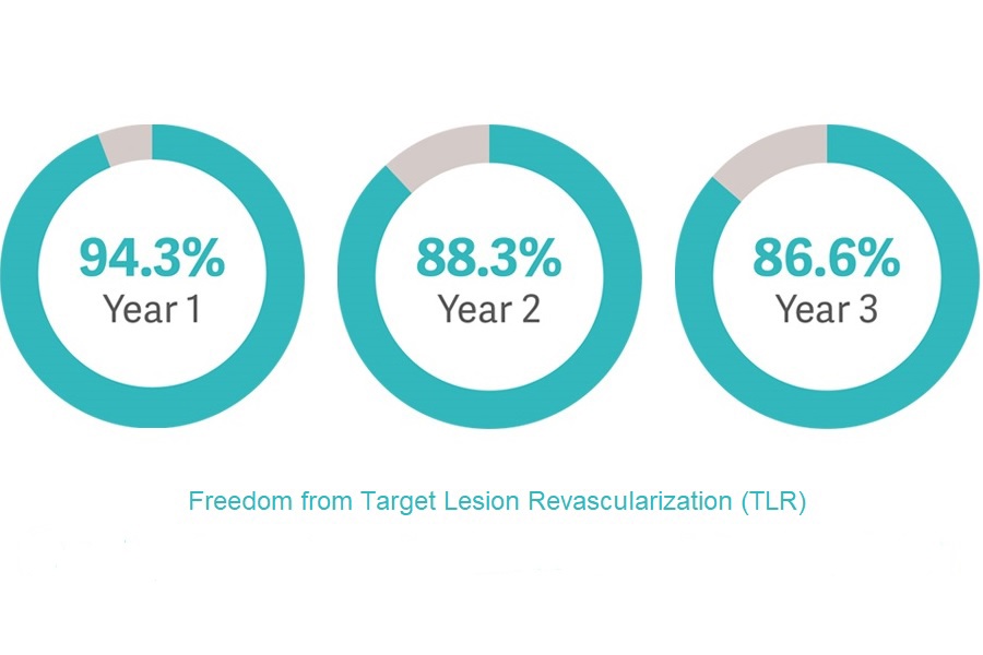 Advanta V12 Balloon Expandable Covered Stent - Getinge