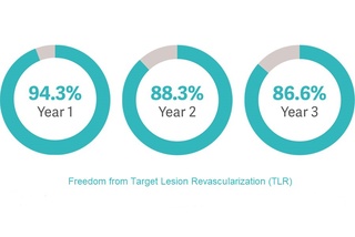 Advanta V12 balloon expandable covered stent - Getinge