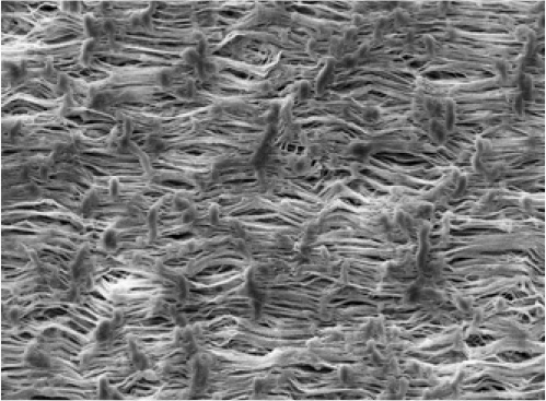 Advanta VXT Vascular Graft - Getinge