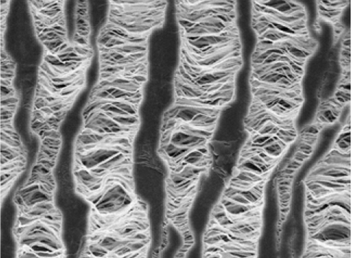 Advanta VXT Vascular Graft