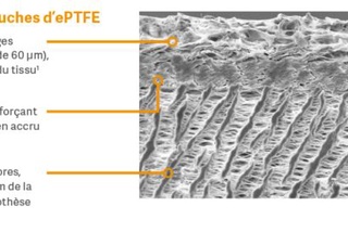 Prothèse vasculaire Flixene - Getinge