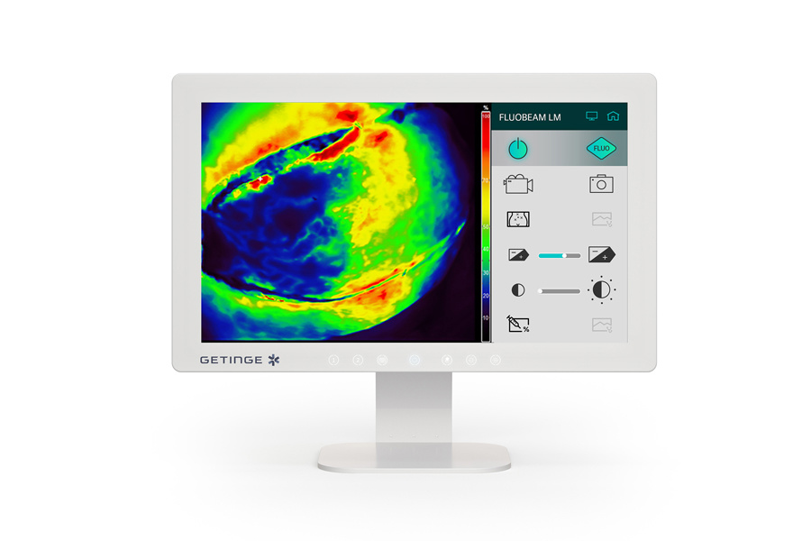 FLUOBEAM® LM - Precision Autofluorescence Imaging for Lymphatic Mapping ...