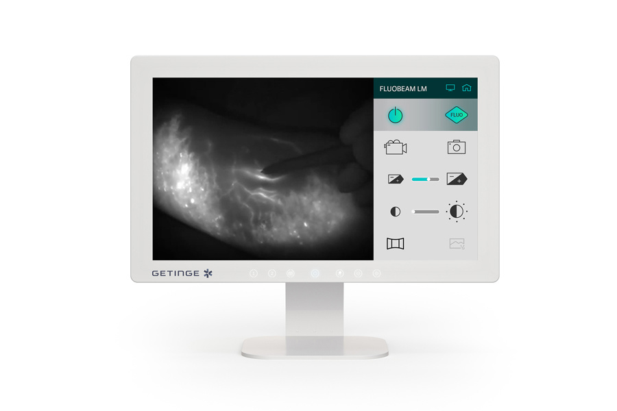 FLUOBEAM® LM - Precision Autofluorescence Imaging for Lymphatic Mapping ...
