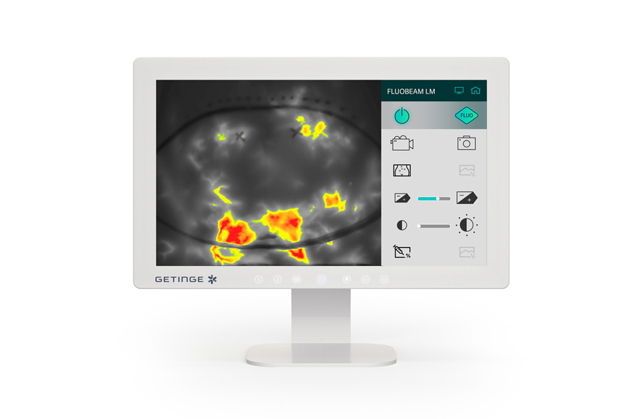 FLUOBEAM® LM - Precision Autofluorescence Imaging for Lymphatic Mapping ...