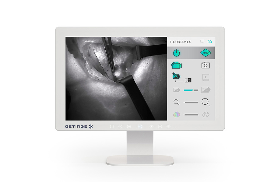 FLUOBEAM® LX - Advanced Autofluorescence Imaging for Parathyroid Glands ...