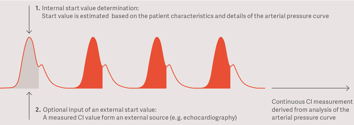 Perioperative Hemodynamic Monitoring