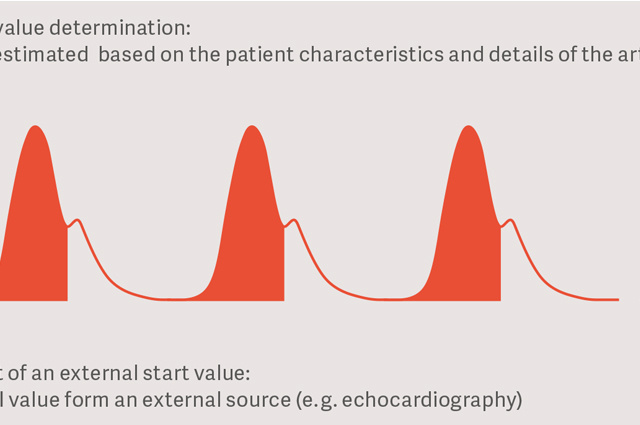 Perioperative Hemodynamic Monitoring - Getinge