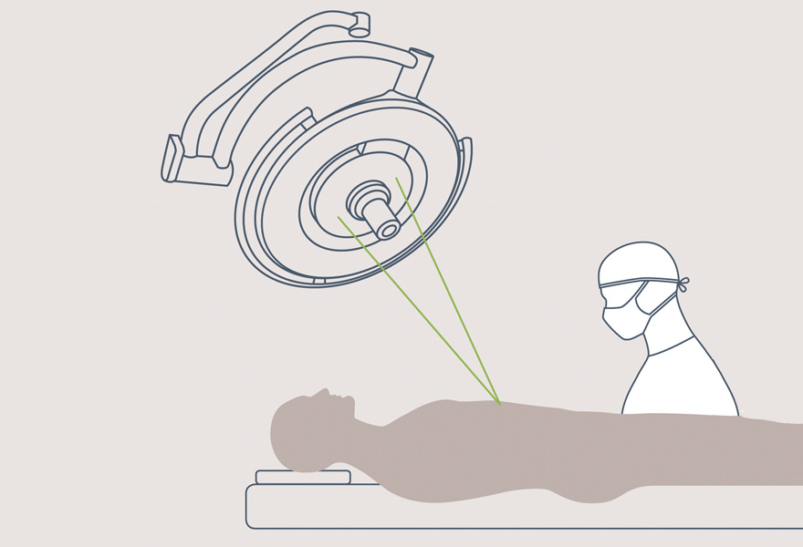 Éclairage opératoire Maquet PowerLED II, tend à réduire la fatigue ...