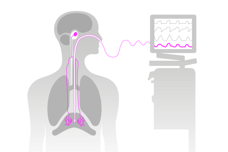 Servo-u/n: How to use NAVA video