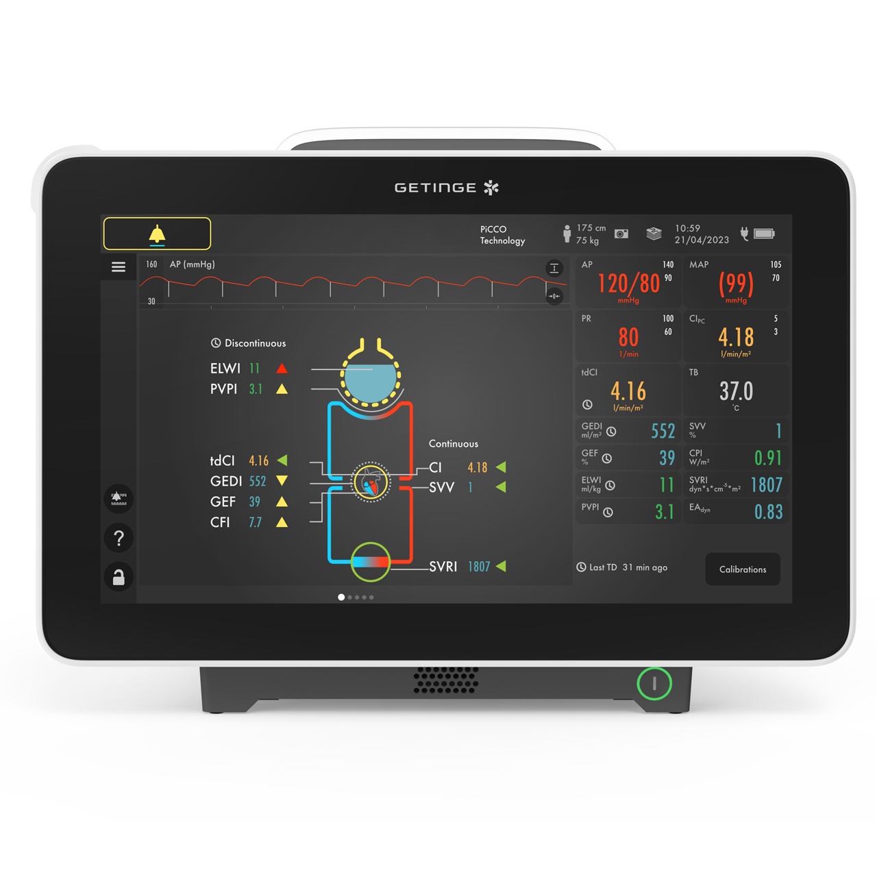 Monitorage hémodynamique avec Pulsiocare - Getinge