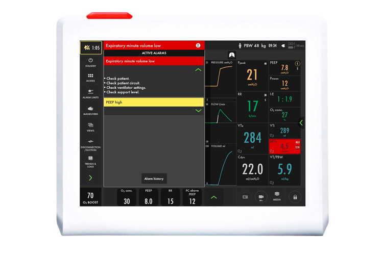 Getinge Servo-air® - Personalized ventialtion meets high mobility - Getinge