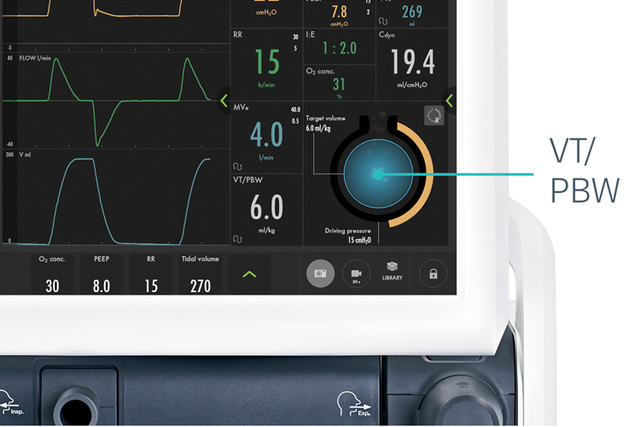 Getinge Servo-air® - Personalized ventialtion meets high mobility
