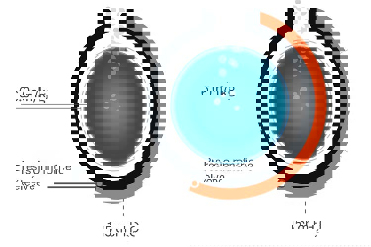 Getinge Servo-u® - le ventilateur mécanique facile à utiliser et le plus sûr à prendre en main