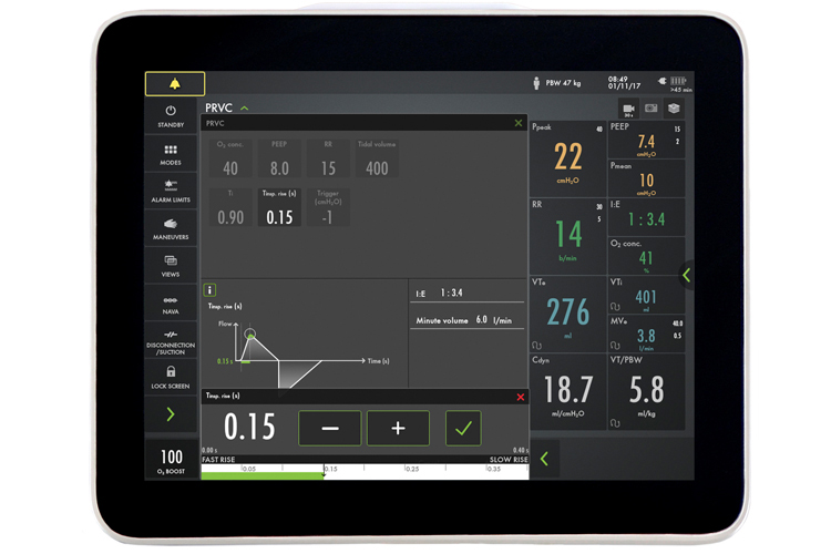Getinge Servo-u® - the simple to use safer to learn mechanical ventilator