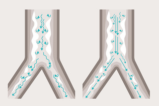 Getinge Servo-u® MR - the MR Conditional ventilator designed with ...