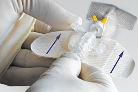 Statlock IAB Stabilization Device