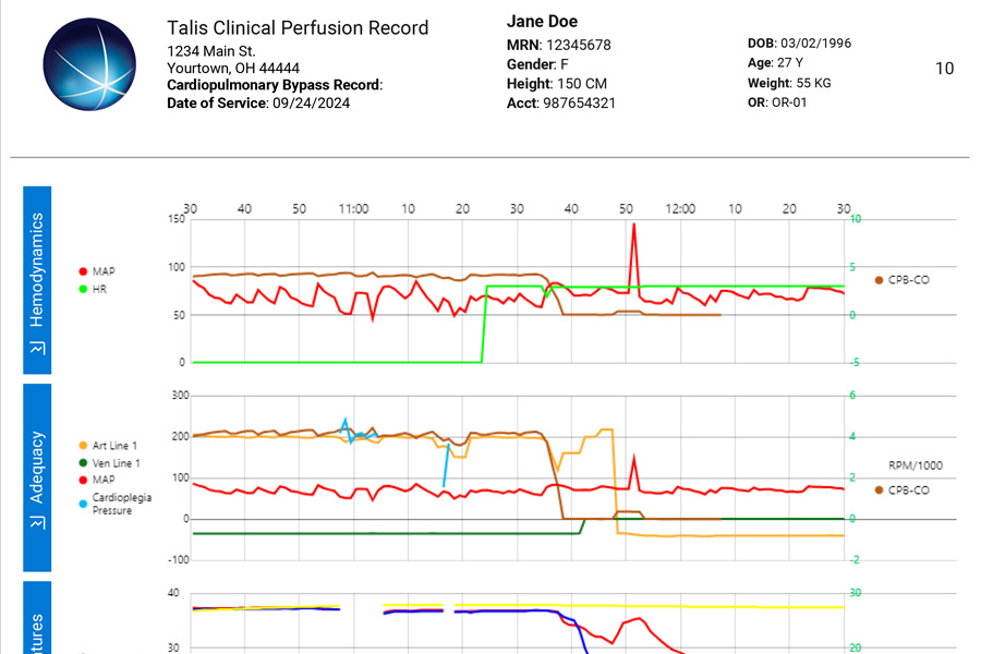 Talis Perfusion with +ACG - Getinge