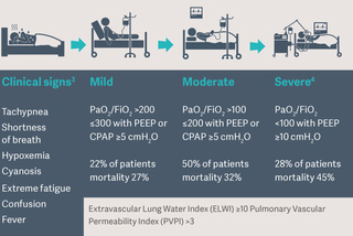 ARDS (acute respiratory distress syndrome)