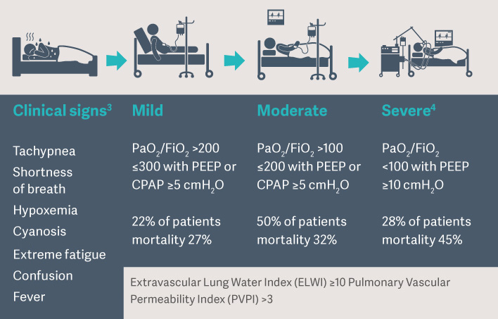 ARDS (acute respiratory distress syndrome)