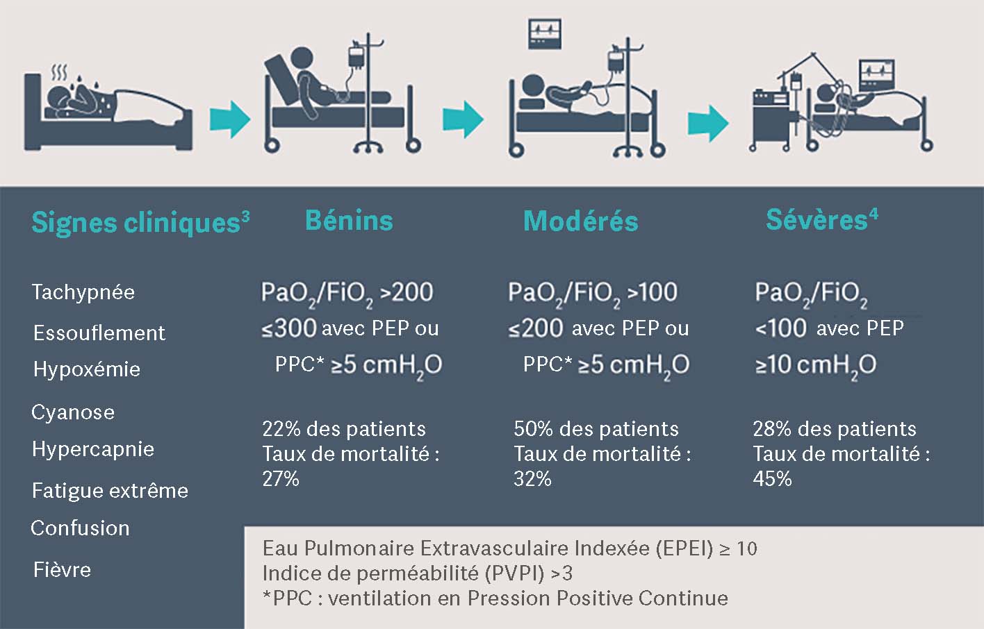 SDRA (syndrome de détresse respiratoire aiguë)