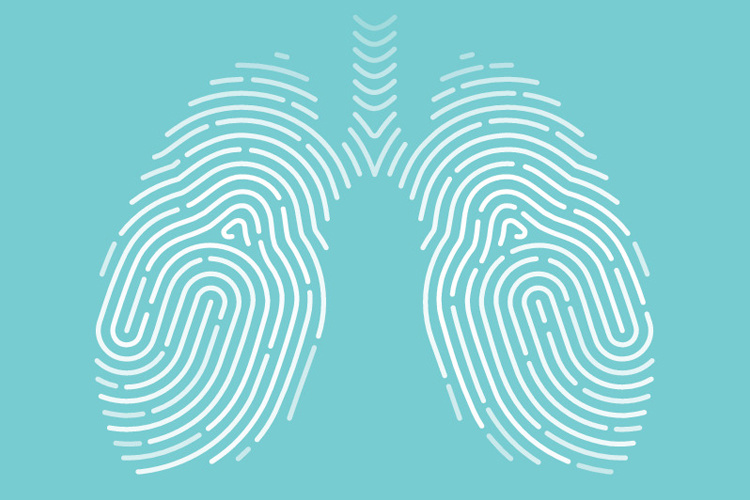 Heliox Helping patients breathe easier - Getinge