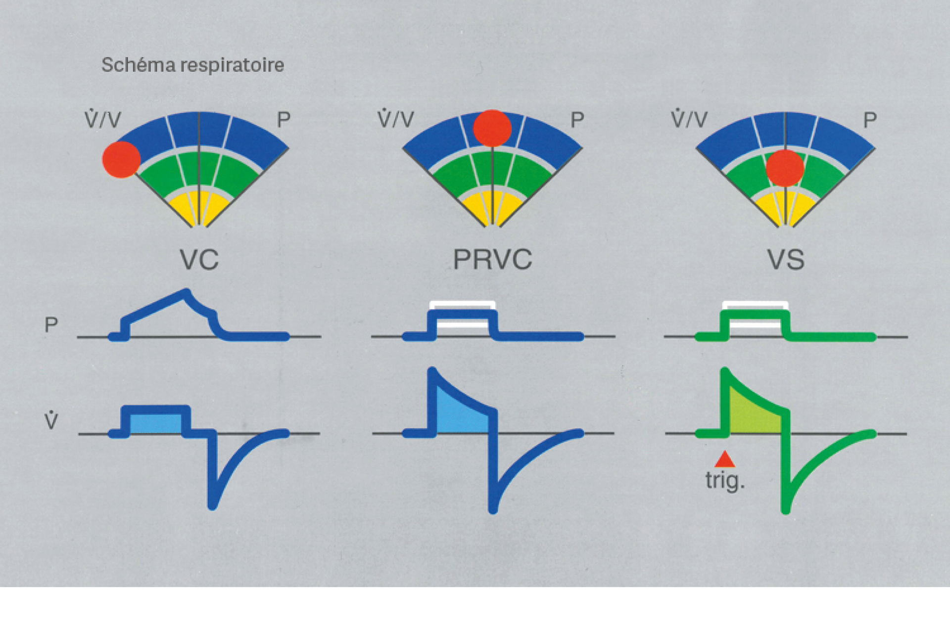 L’histoire du ventilateur Servo - Getinge