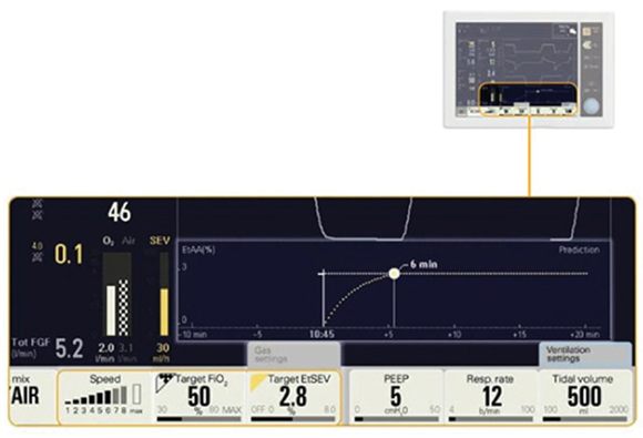 Getinge Anesthesia system