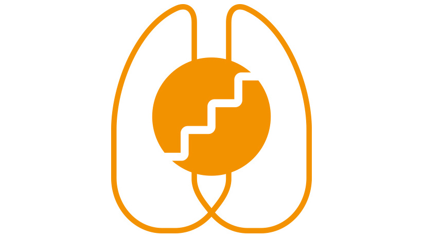 Anesthesia Hypoxia prevention Getinge O2Guard - Getinge