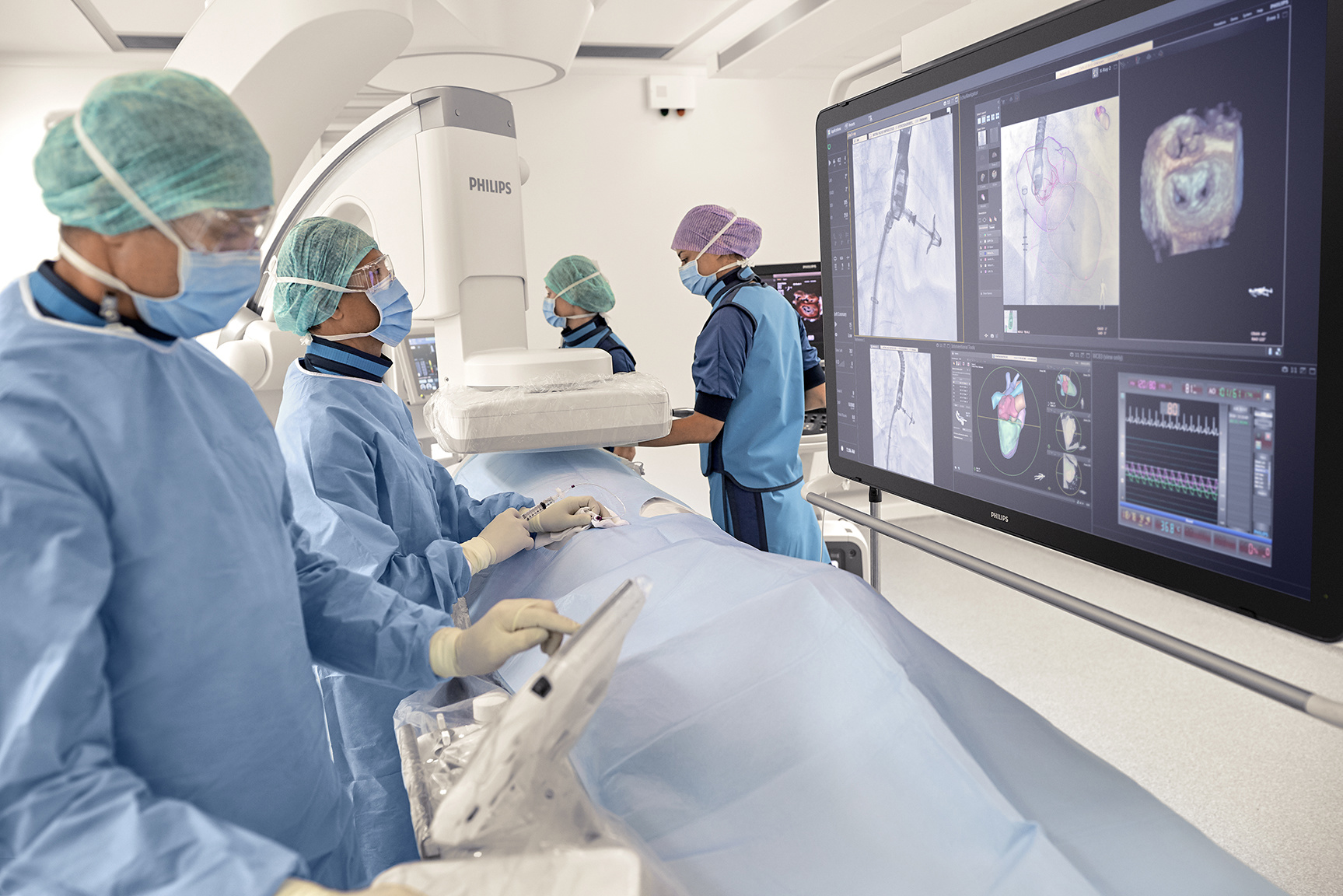 Innovazione nelle sale operatorie ibride - Getinge